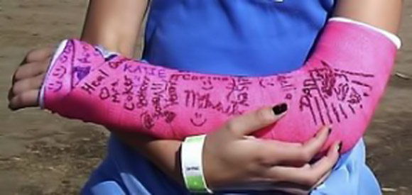 Out of My Cast: What Do I Do Now?